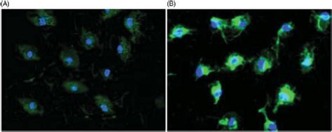 Cellular Uptake Of Free Curcumin A And Nanoformulated Curcumin B Download Scientific
