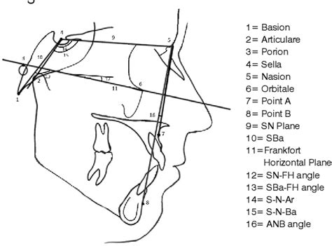 Figure 2 3 From Comparison Of Two Cranial Base Lengths And Four Angles Among Three Sagittal