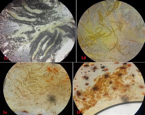 Vermiform Và Bệnh Phân Trắng Trên Tôm Người Nuôi Tôm