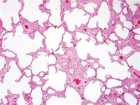A Pattern Based Approach To Diagnosis Clinical Tree