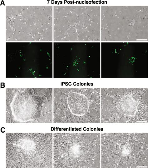 Reprogramming Of Human Fibroblasts On Vitronectin Coated Dishes In Download Scientific Diagram