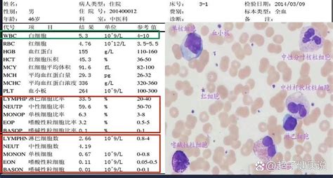读懂血常规之白细胞
