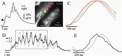 Electrical And Optical Recordings During Spontaneous Episodes Of Download Scientific Diagram