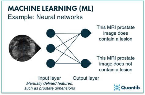The Ultimate Guide To Ai In Prostate Cancer