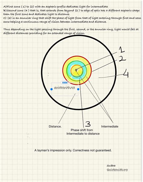 Vivity Extended Depth Of Focus Lens