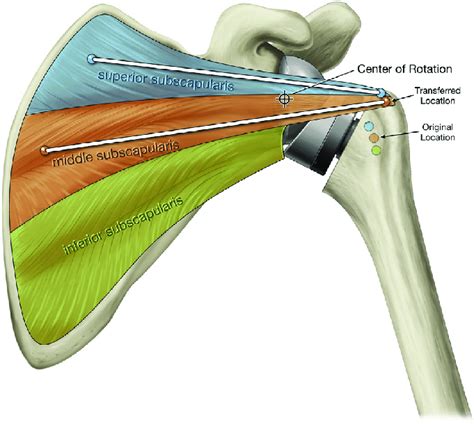 Subscapular Fossa Subscapularis Anatomyapp