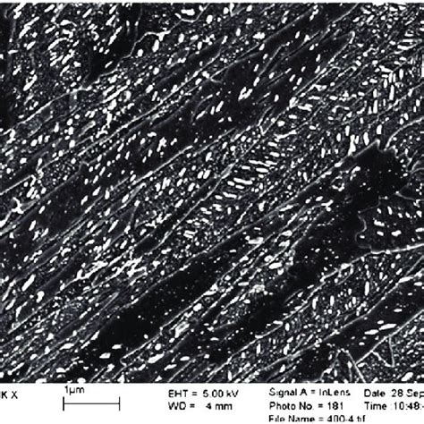 Typical Microstructure Of The Lower Bainite With Carbides Download