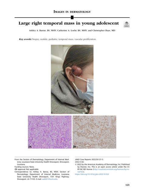 Pdf Large Right Temporal Mass In Young Adolescent