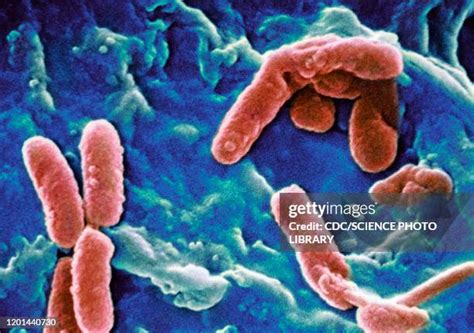Pseudomonas Aeruginosa Photos And Premium High Res Pictures Getty Images