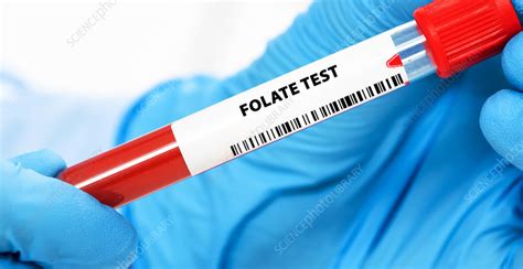 Folate Test Stock Image F0447364 Science Photo Library