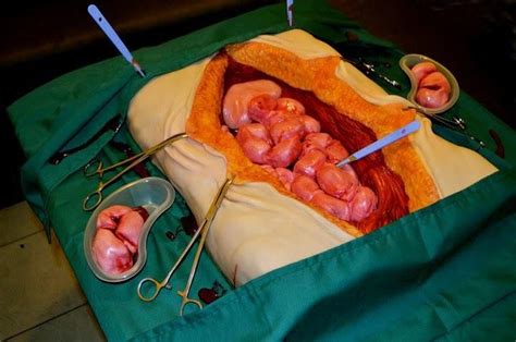 Surgery Cake R Atbge