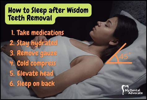 Sleeping After Wisdom Teeth Removal