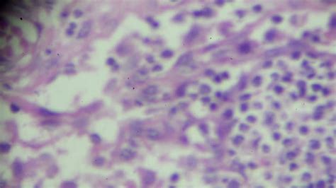 106 Human Body Under The Microscope Stock Videos Footage And 4k Video