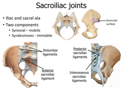 Week 12 Ms Spinal Pgp Sacroilliac Joint Flashcards Quizlet