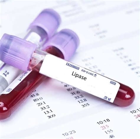 Understanding Lipase Function Test And Pancreatic Health Mydiagnostics