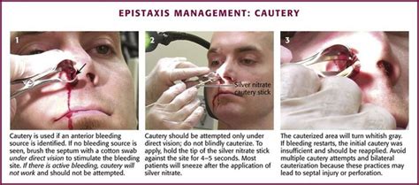 Otolaryngologic Procedures Clinical Gateclinical Gate