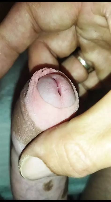 Deslumbrante Pau E Prepúcio Xhamster