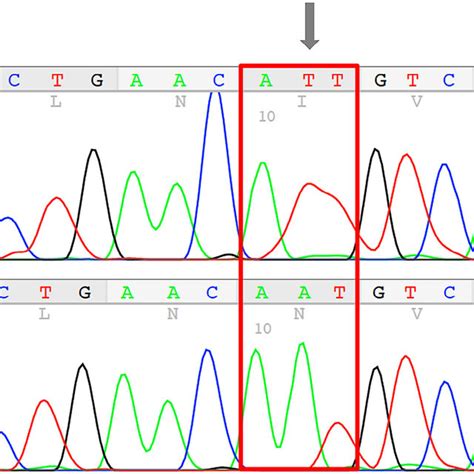 Detected Variants In The Dmd Gene By Pyrosequencing Download Scientific Diagram