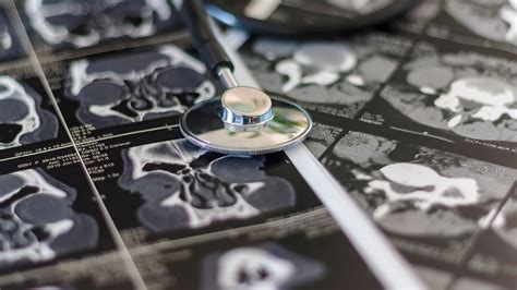 Sinusite Viral Causas Sintomas E Tratamento Dra Danielly Andrade