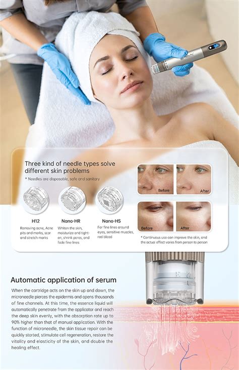 3 Best At Home Microneedling Pens For Your Skincare Needs Artofit