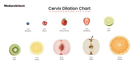 Pregnancy Cervix Dilation Chart Stages Of Labor Medarchitect