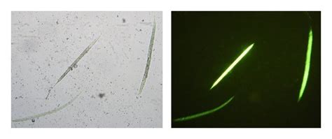 Dead C Elegans Larvae L3 Bright Field Images On The Left And