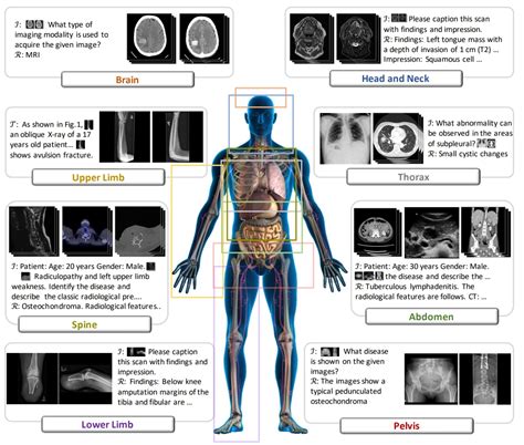 Towards Generalist Foundation Model For Radiology By Leveraging Web