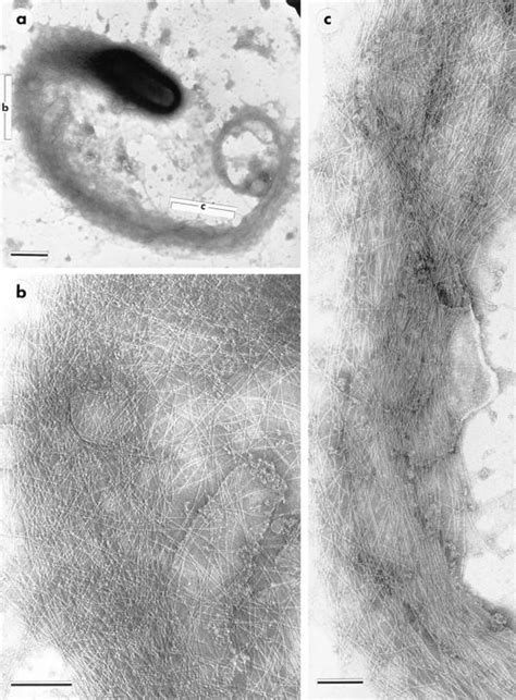 Isolated Ptk2 Pseudopodium A Indicating Regions Bracketed Shown At Download Scientific