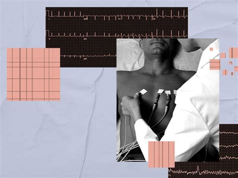 AFib Vs VFib Similarities Differences Treatment And More