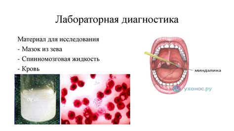 Патогенные кокки Пневмококки менингококки гонококки презентация онлайн
