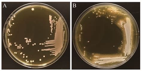 Lactobacillus Acidophilus Plate