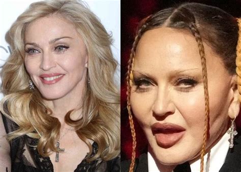 Madonnas Transformation Shocking New Look At Grammy Awards