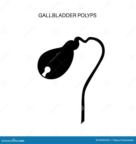 Gallbladder Polyp Anatomy Stock Vector Illustration Of Internal