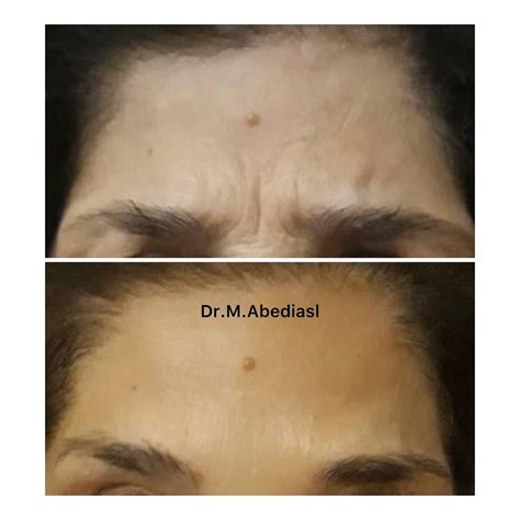 ‎دکتر مونا عابدی اصل‎ Drmonaabediasl • Instagram Photos And Videos