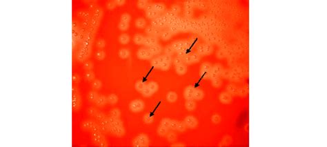 Streptococcus Pyogenes Microbiology Class