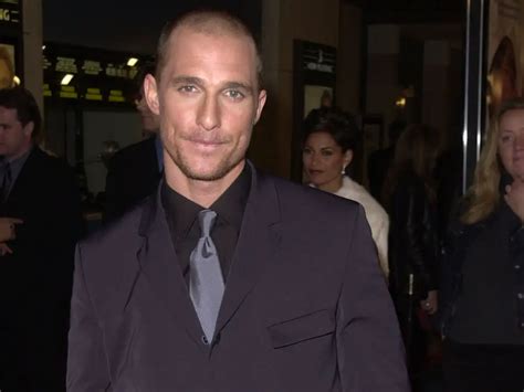 کاشت مو متیو مک کانهی