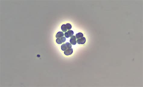 Tetrads Ryan Hennessy Wastewater Microbiology