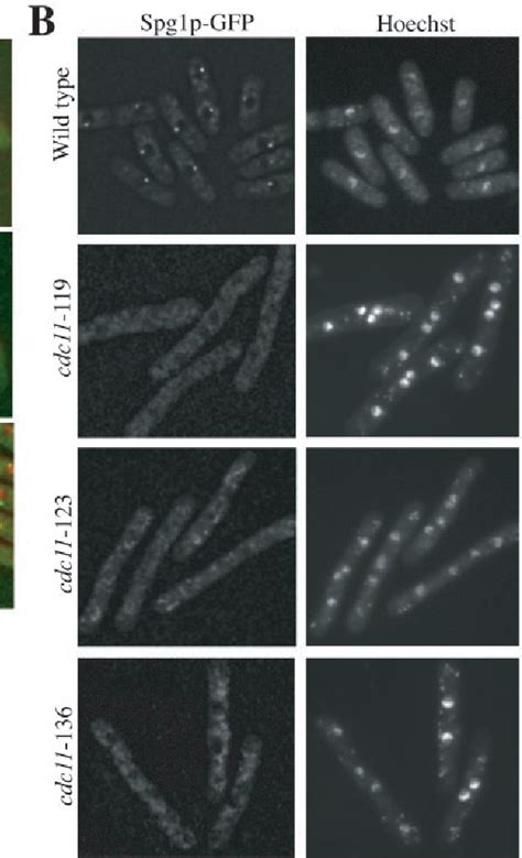 Figure 4 From The Spindle Pole Body Protein Cdc11p Links Sid4p To The Fission Yeast Septation