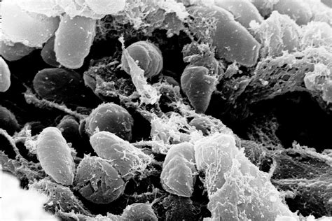 Black Plague Black Death At The Golden Gate The Race To Save America