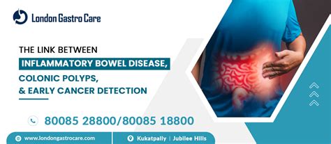 The Link Between Inflammatory Bowel Disease Colonic Polyps And Early Cancer Detection London