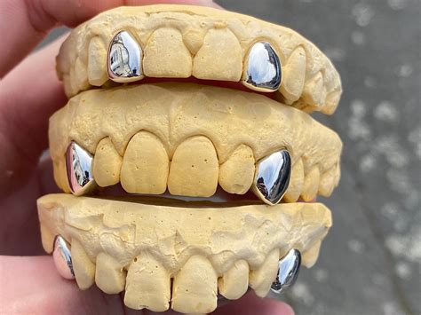 Can Silver Caps Be Removed At Jacob Bremer Blog