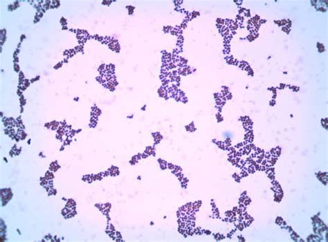 Lab Practical Staining Flashcards Quizlet Lab Practical Staining Flashcards Quizlet