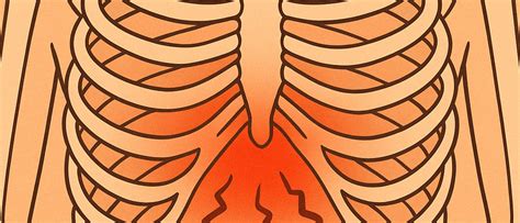 Alles Wat Je Moet Weten Als Je Last Heb Van Je Xiphoid