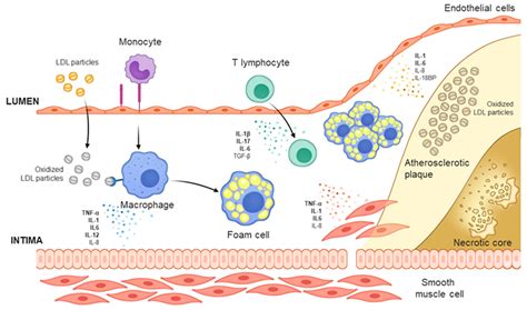 Foam Cell Atherosclerosis