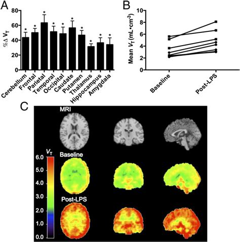 Lps Administration Significantly Increases 11 C Pbr28 Binding V T