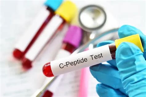 Guide To C Peptide Test Normal Range