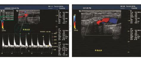 病例详情 病例 人卫临床助手 人民卫生出版社