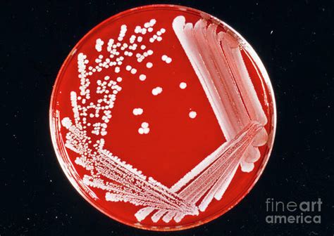 Culture Of Staphylo Coccus Bacteria Art Print By Science Photo Library