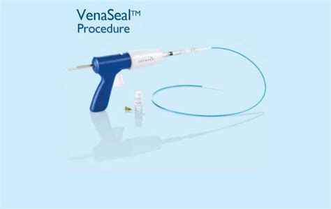 Venaseal™ Tepas Vein Center