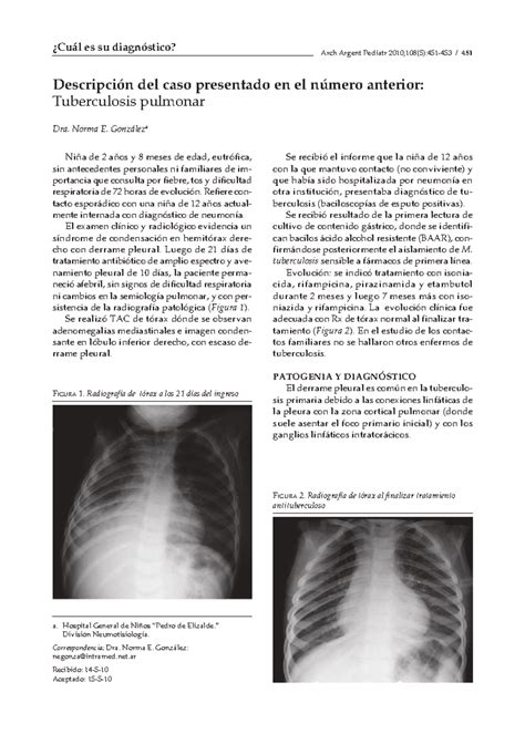 Análisis De Caso Tuberculosis Pulmonar En Niña De 2 Años Arch Argent